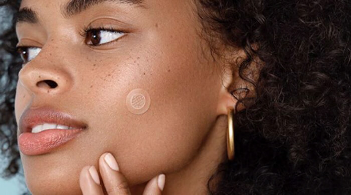 Everything You Need to Know About Acne Healing Dots